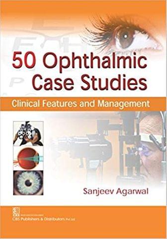 50 Ophthalmic Case Studies Clinical Features And Management 2018 By ...